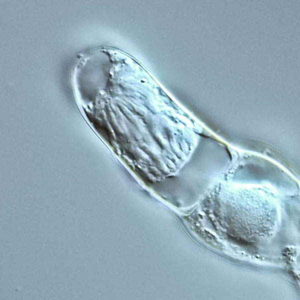 Cell division in Tradescantia stamen hair cel