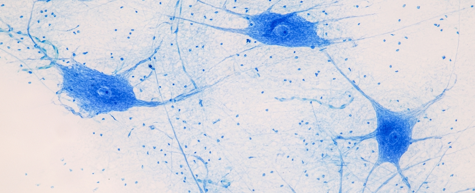 Atom Probe Field Ion Microscopy (APFIM)